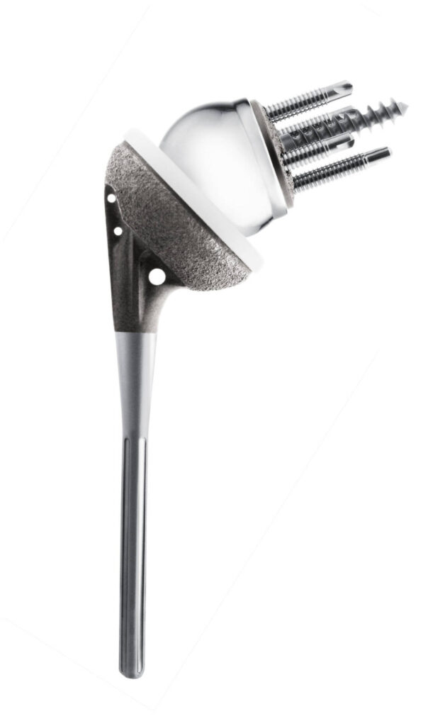 Prótesis Reversa de Hombro (RSP®) DJO Surgical – Tempomedical